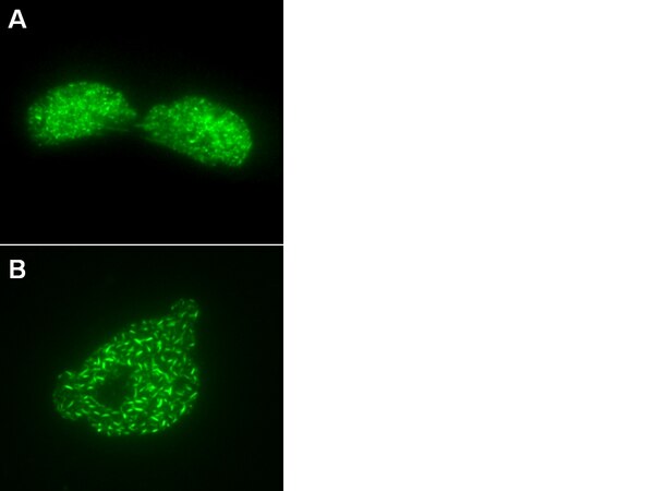 LentiBrite™ GFP-Rad51 Lentiviral Biosensor | 17-10234